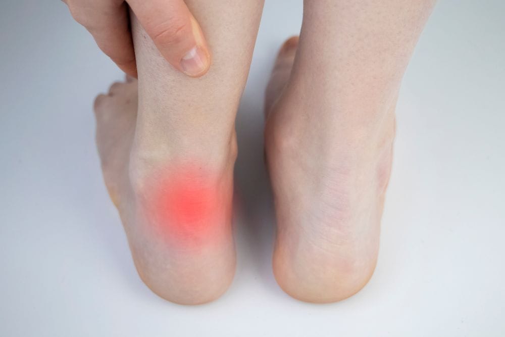 Tendinitis: qué es, cómo identificarla y tratamientos para el dolor